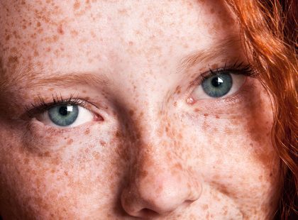 Irish Skin Foundation - Supporting people with skin conditions