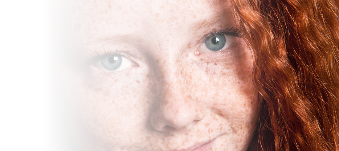 Irish Skin Foundation - Supporting people with skin conditions