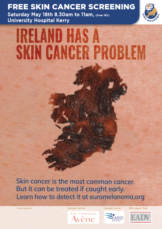 University Hospital Kerry to Launch Pigmented Lesion Clinic on 18th May ...