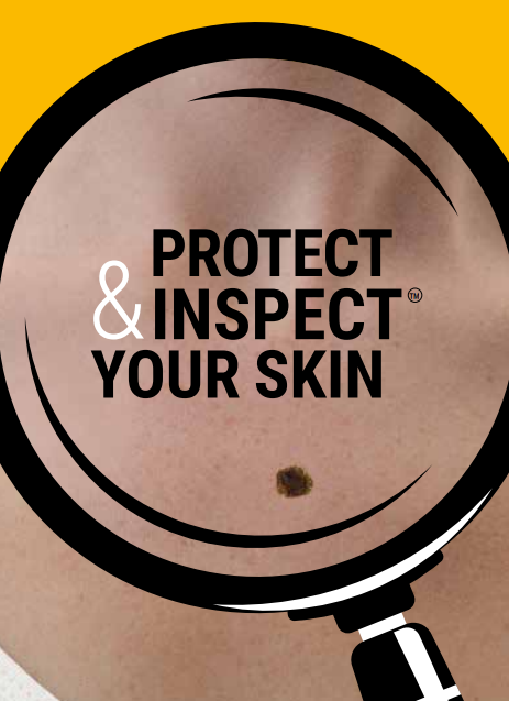 ISF Publishes New Melanoma Skin Cancer Leaflet - Irish Skin Foundation