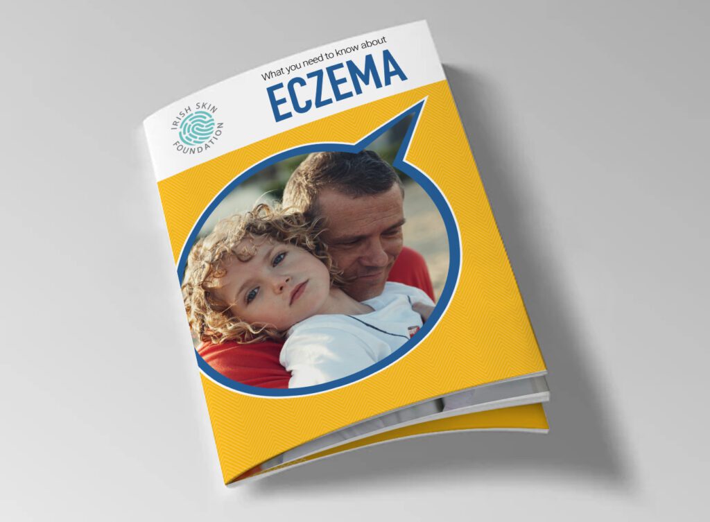 Eczema - Irish Skin Foundation